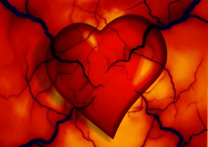 Structural heart disease causes, Symptoms - HealthPulls