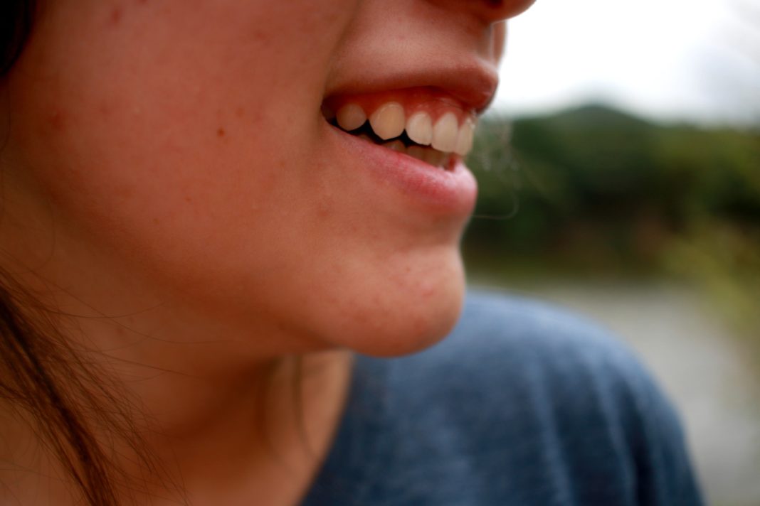 How to get rid of acne scars, home tips - HealthPulls