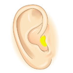 Types of Ear Discharge and Associated Best Treatments - HealthPulls