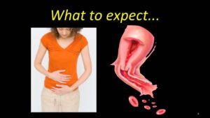 Fetal Demise: Causes, Symptoms, Risks, Treatment & Diagnosis